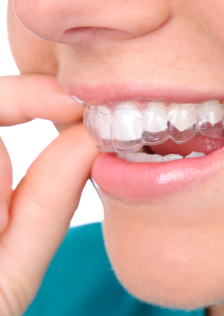 Drs Ngema & Dubula Orthodontist’s – Changing Smiles Changing Lives